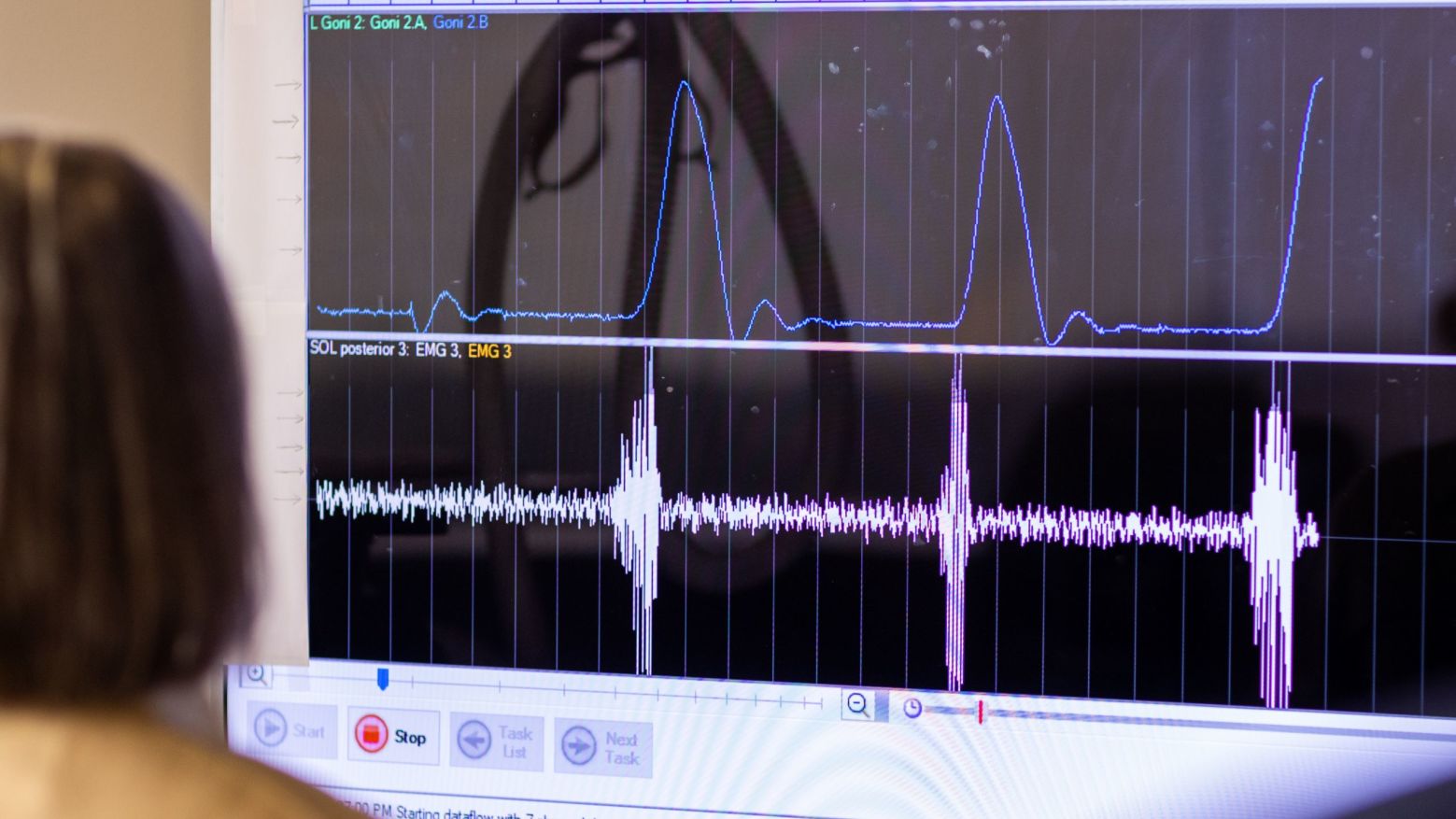 Discovery Unlocks Potential of 'Special' Muscle